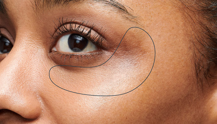 fact check: is hydroquinone safe? — Dermalogica NZ